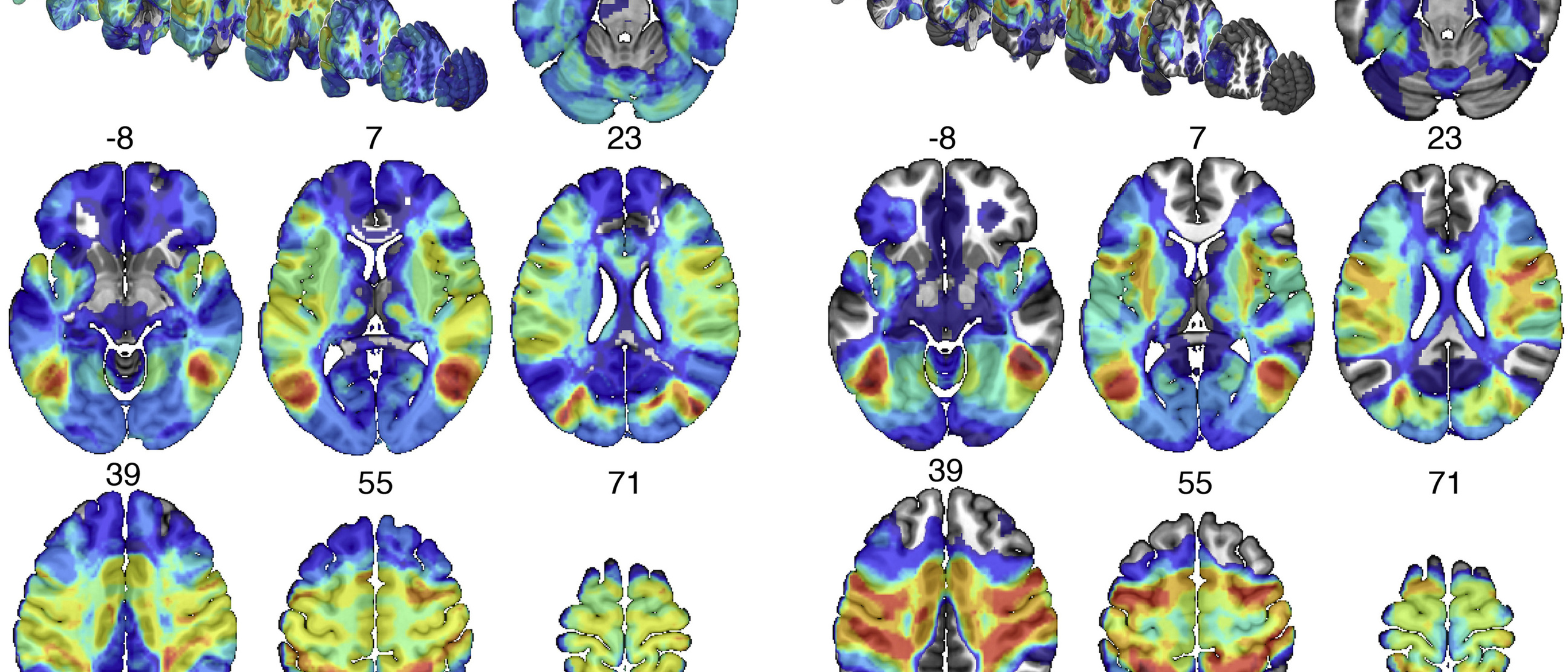 Publications | The Boes Lab: Iowa's Neuroimaging & Noninvasive Brain ...